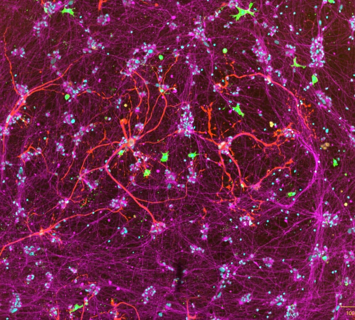 Expert iPSC Services for Drug Discovery | Elixirgen Scientific