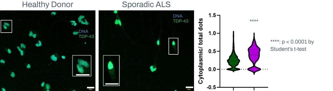 iPSCs in Disease Modeling & Drug Discovery | Elixirgen Scientific