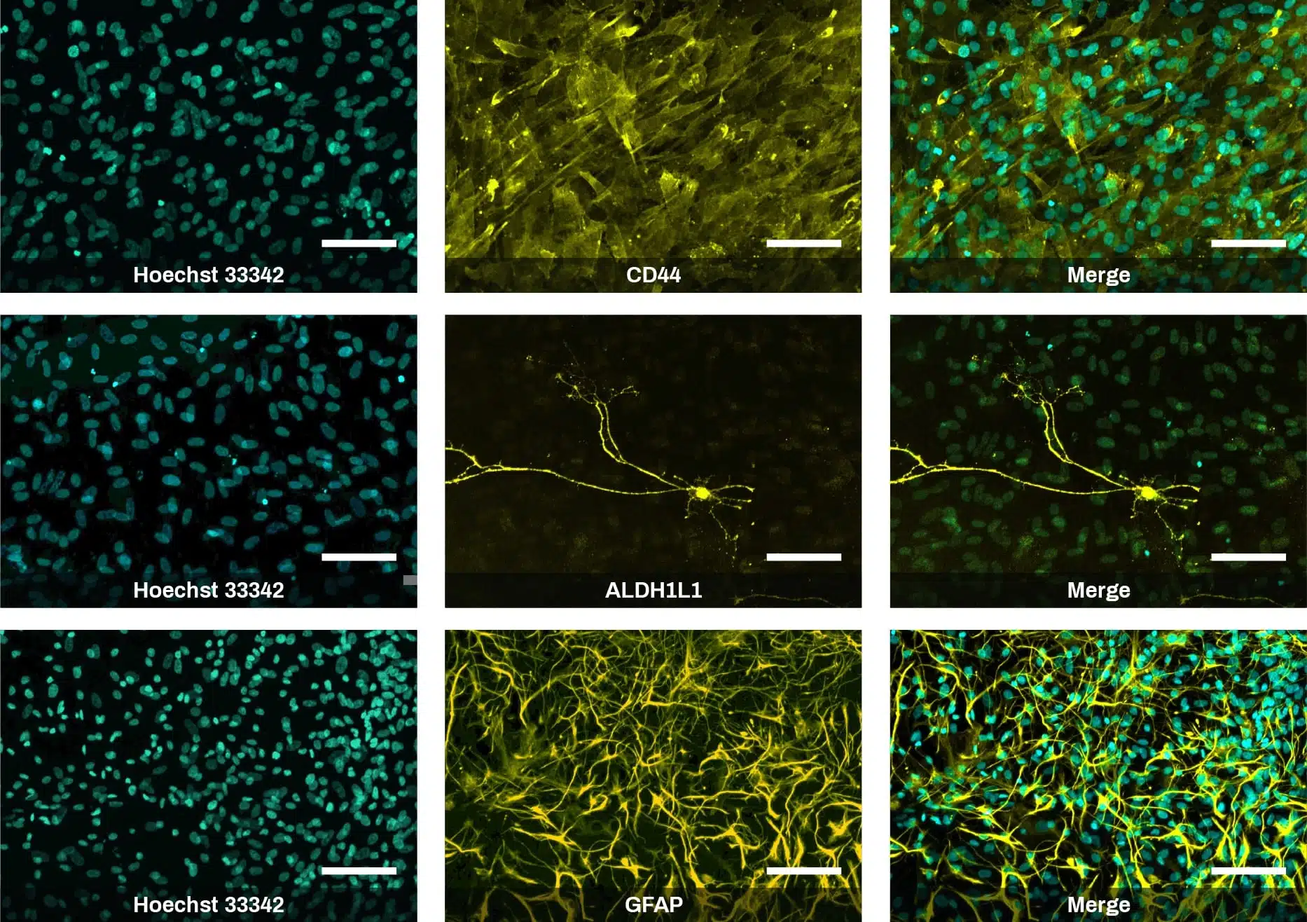 Human iPSC-Derived Astrocytes | Quick-Glia™ Astrocytes