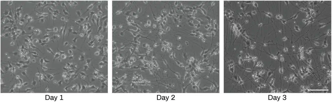 Quick-Neuron™ Cholinergic – iPSC-Derived Cholinergic Neurons