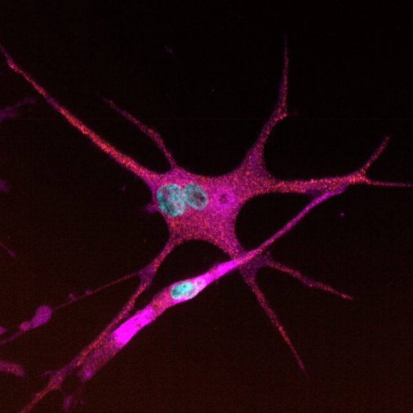 Quick-Glia™ Microglia - iPSC-Derived Microglia