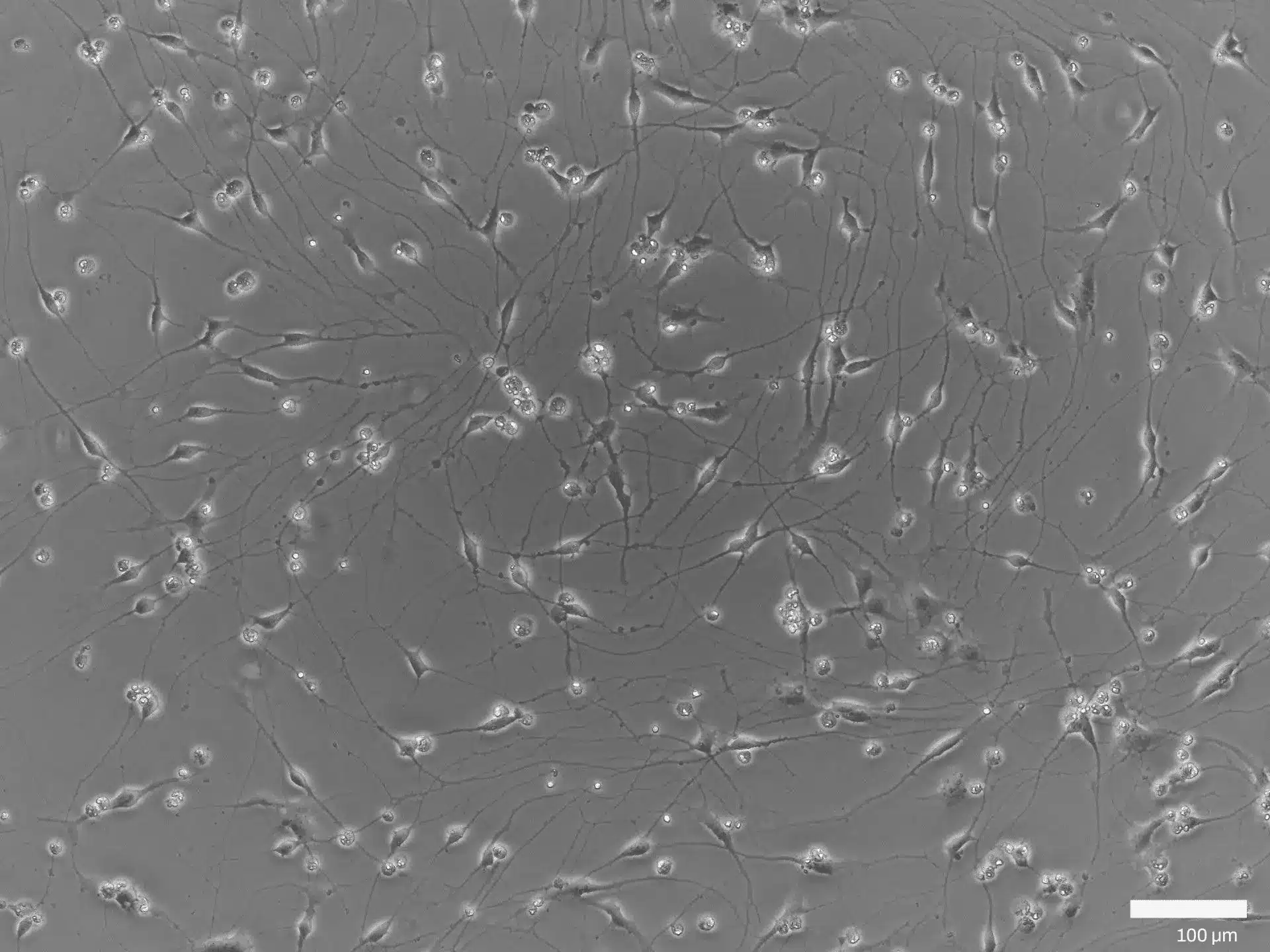 Amyotrophic Lateral Sclerosis (ALS) | Ricoh Biosciences